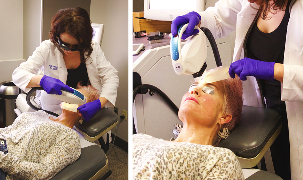 About My Light Laser Facial - Chic Over 50